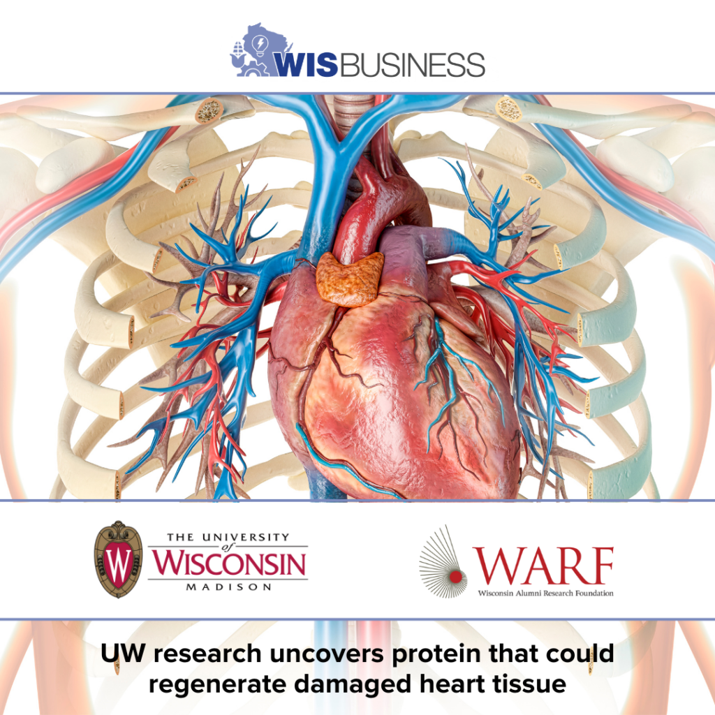 UW research uncovers protein that could regenerate damaged heart tissue ...